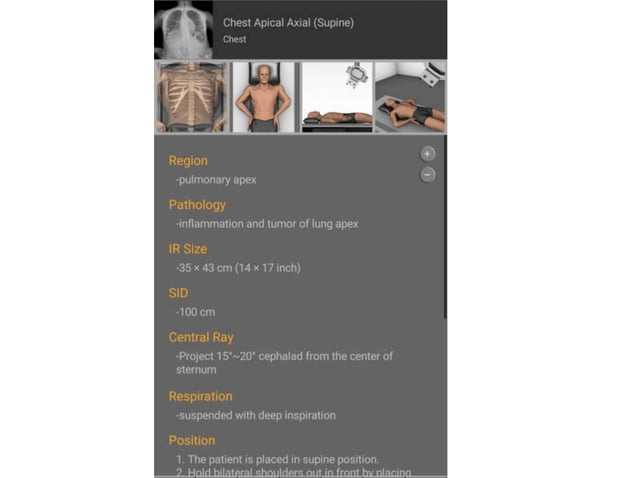 Presentation chest.pptx x ray positioning of chest | PPT