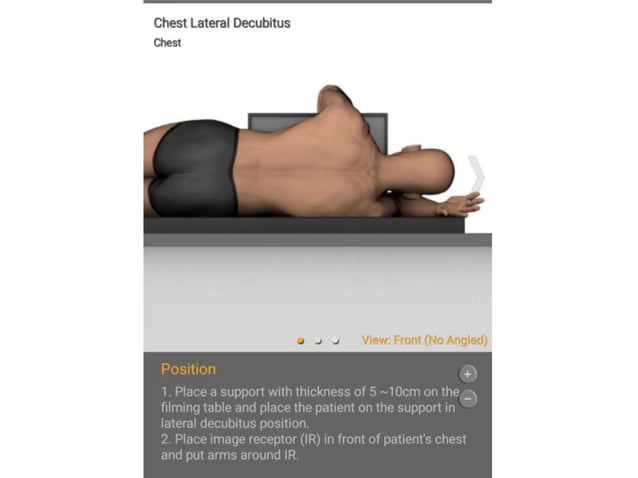 Presentation chest.pptx x ray positioning of chest | PPT