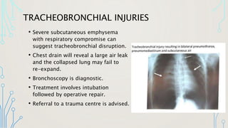 Presentation chest trauma-1.pptx