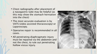 Presentation chest trauma-1.pptx