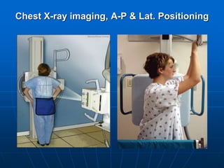 presentation chest X-ray 2.ppt