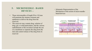 Permeation enhancer of Transdermal drug delivery system | PPTX