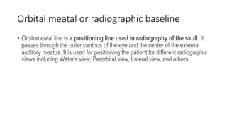 Presentation chibu.pptx