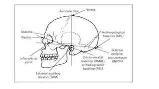 Presentation chibu.pptx