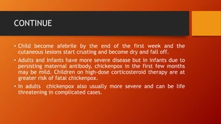 chickenpox presentation | PPTX