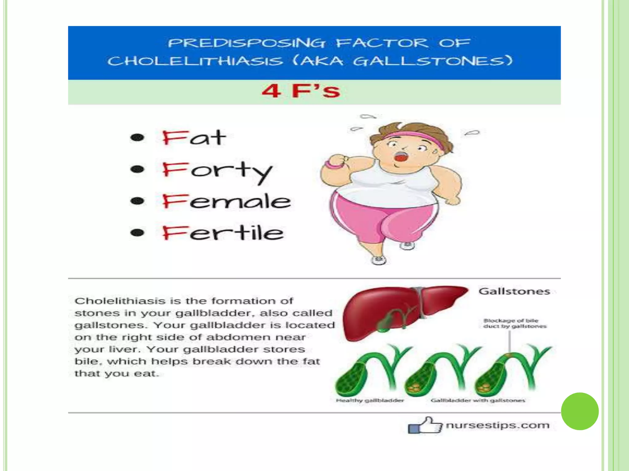 Presentation cholelithiasis | PPTX