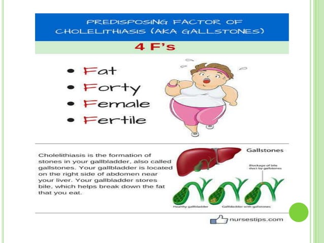 Presentation cholelithiasis | PPTX