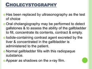 Presentation cholelithiasis | PPTX
