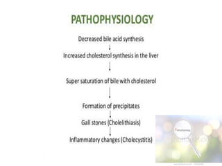 Cholelithiasis Pathophysiology