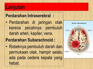 Cidera Kepala | PPTX