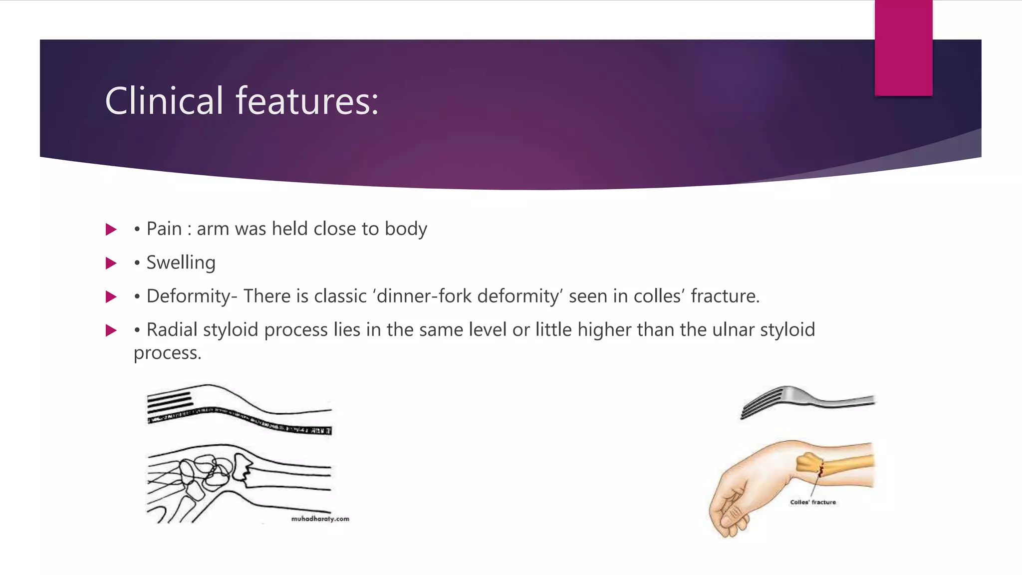 Presentation colles | PPTX