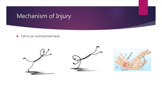 Presentation colles | PPT