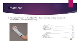 Presentation colles | PPT