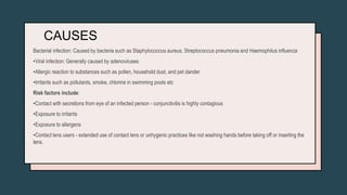 PRESENTATION CONJUNCTIVITIS.pptx