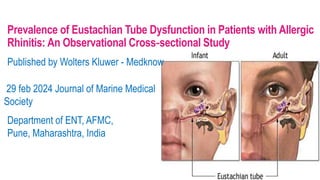 Eustachian tube dysfunction, a journal Club presentation | PPTX ...