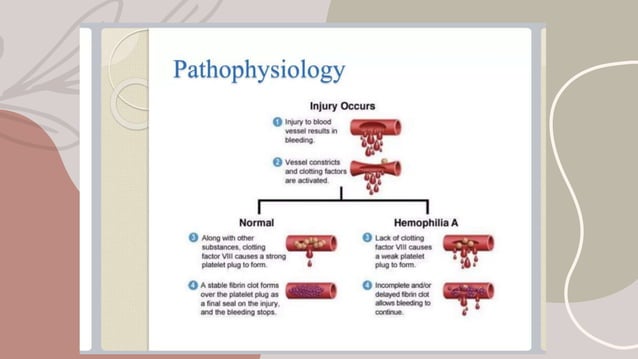 hemostasis, pathology review, pathology exercise | PPT