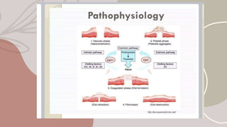 hemostasis, pathology review, pathology exercise | PPT