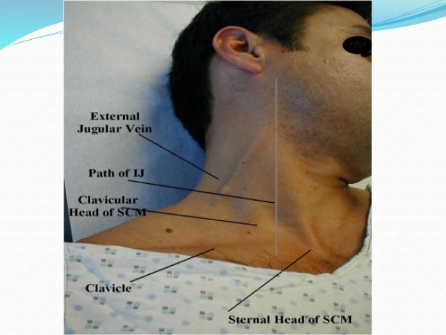 JVP by Dr Manish Ruhela