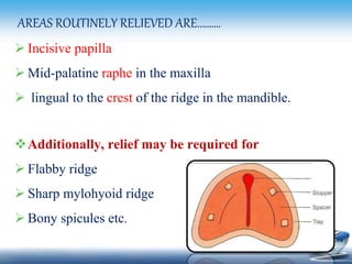 Complete denture 1.ppt
