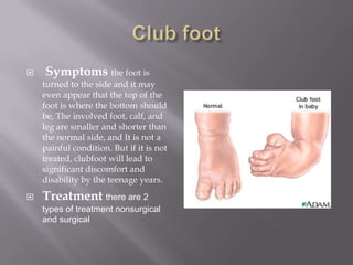 Famous People with Disabilities | PPTX