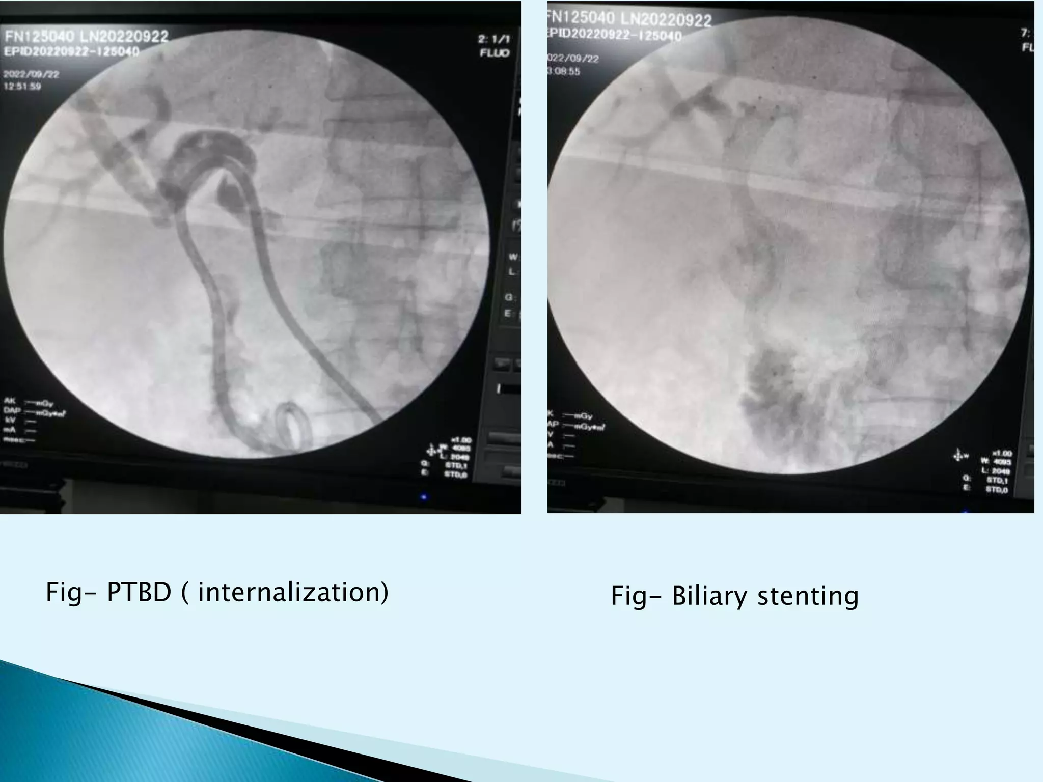 Presentation editing.pptx | Blood Disorders | Diseases and Conditions