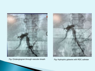 Presentation editing.pptx | Blood Disorders | Diseases and Conditions