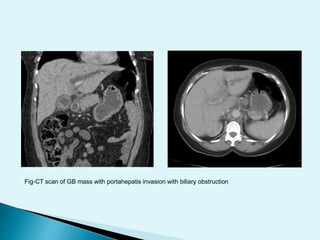 Presentation editing.pptx | Blood Disorders | Diseases and Conditions