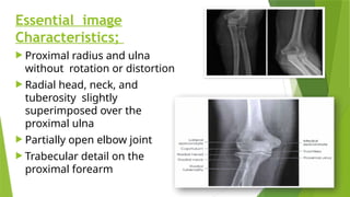 Elbow radiographic presentation Presentation elbow.pptx