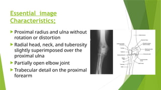 Elbow radiographic presentation Presentation elbow.pptx