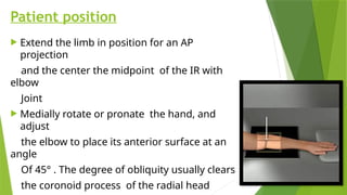Elbow radiographic presentation Presentation elbow.pptx