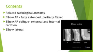 Elbow radiographic presentation Presentation elbow.pptx
