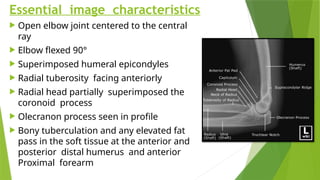 Elbow radiographic presentation Presentation elbow.pptx