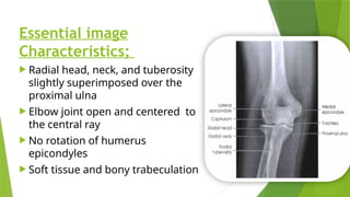 Elbow radiographic presentation Presentation elbow.pptx