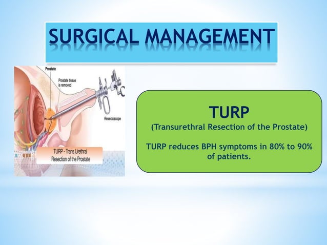 Presentation enlarged prostate | PPTX | Sexual Conditions | Sexual Health
