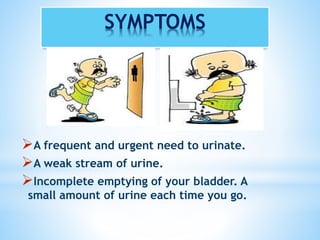 Presentation enlarged prostate | PPTX