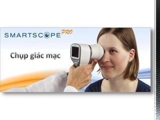 Máy chụp đáy mắt di động - SMARTSCOPE PRO | PPTX