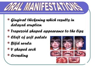 craniofacial anomalies down , apert's and gorlin goltz syndrome | PPT
