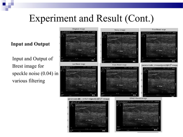 Speckle Noise Reduction in Ultrasound Images using Adaptive and Anisotropic Diffusion filter | PPT