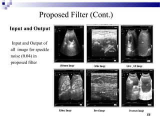 Speckle Noise Reduction in Ultrasound Images using Adaptive and Anisotropic Diffusion filter | PPT