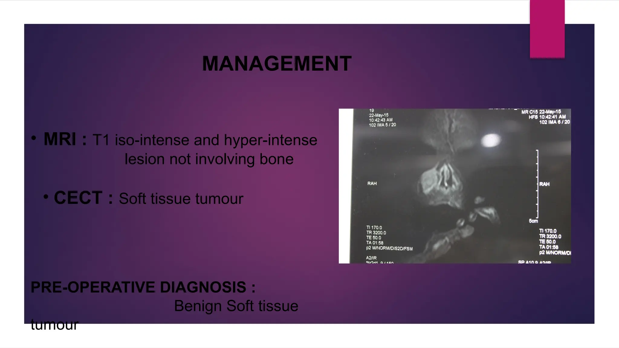 Congenital facial tumor: a rare site of infantile fibromatosis | PPT