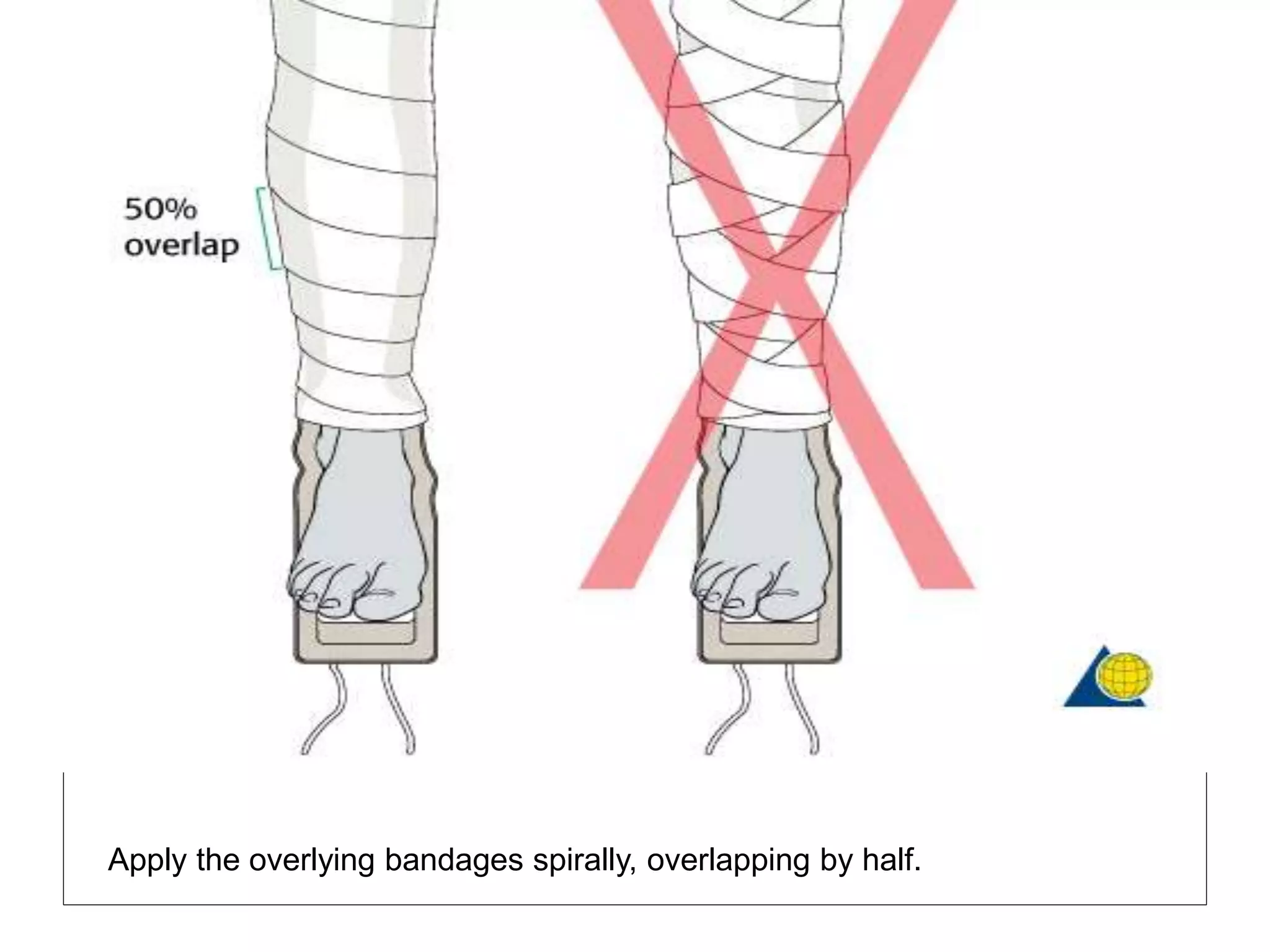 Ortho - Splinting, Traction, POP | PPT