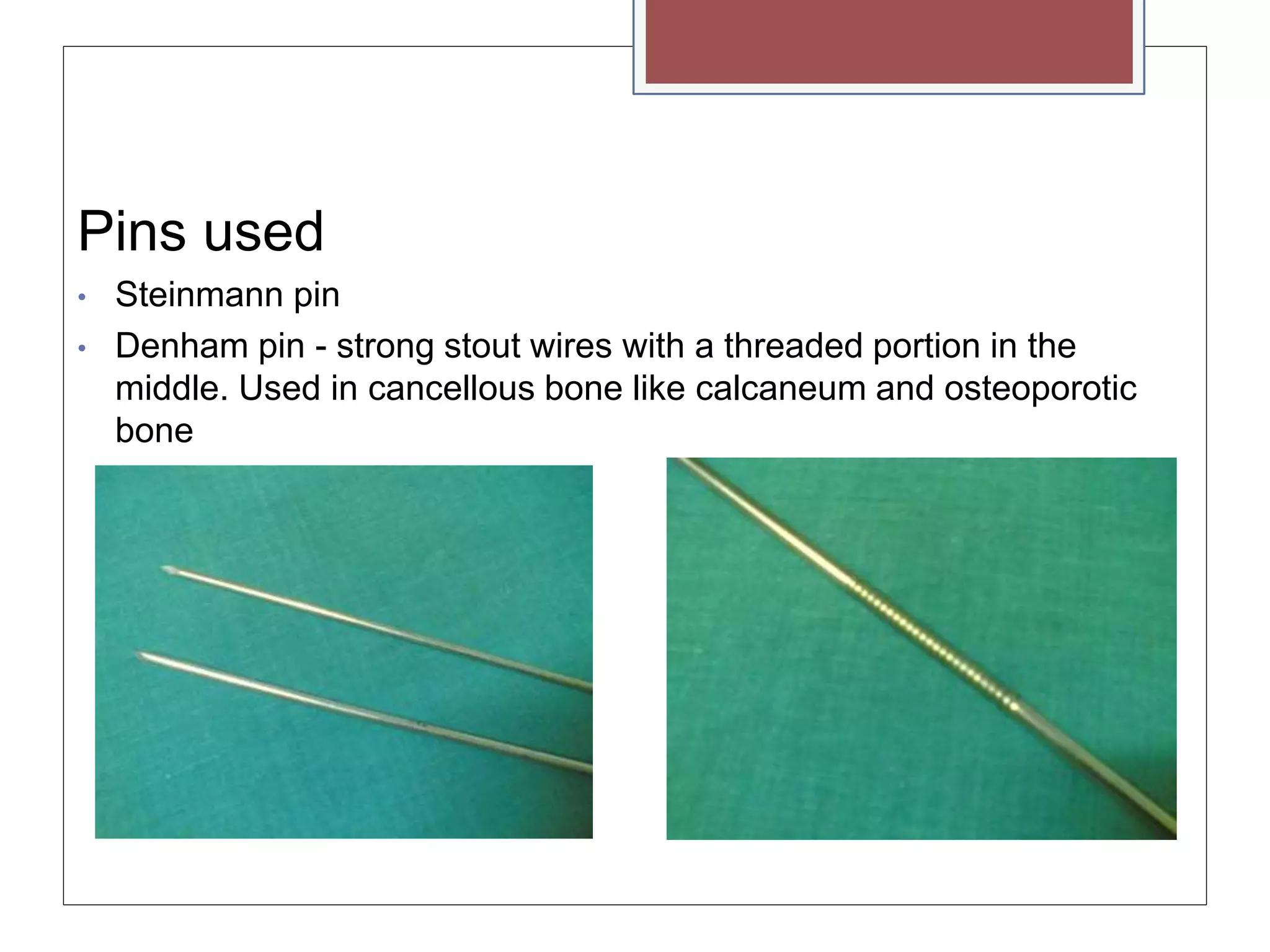 Ortho - Splinting, Traction, POP | PPT