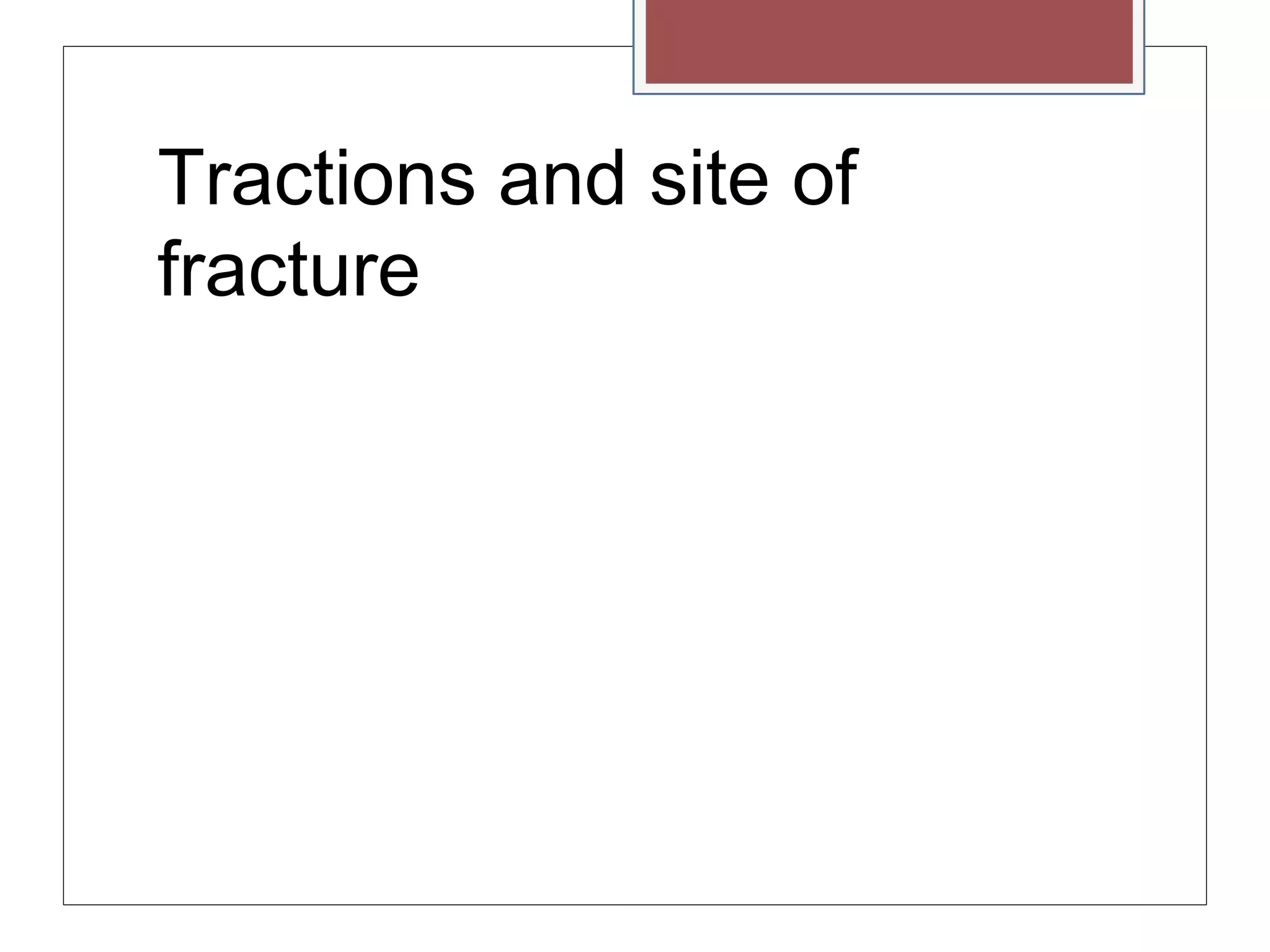 Ortho - Splinting, Traction, POP | PPT