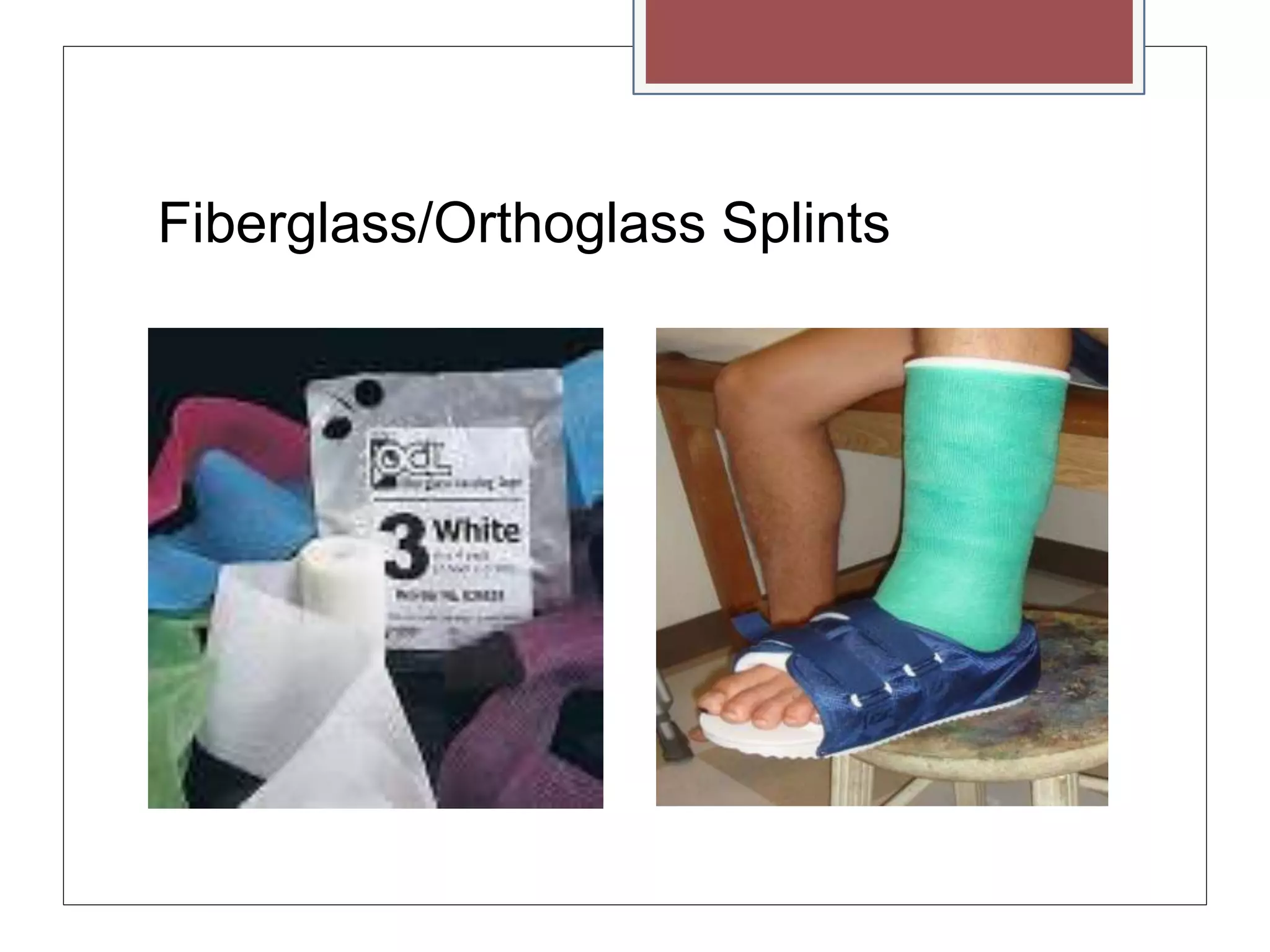 Ortho - Splinting, Traction, POP | PPT
