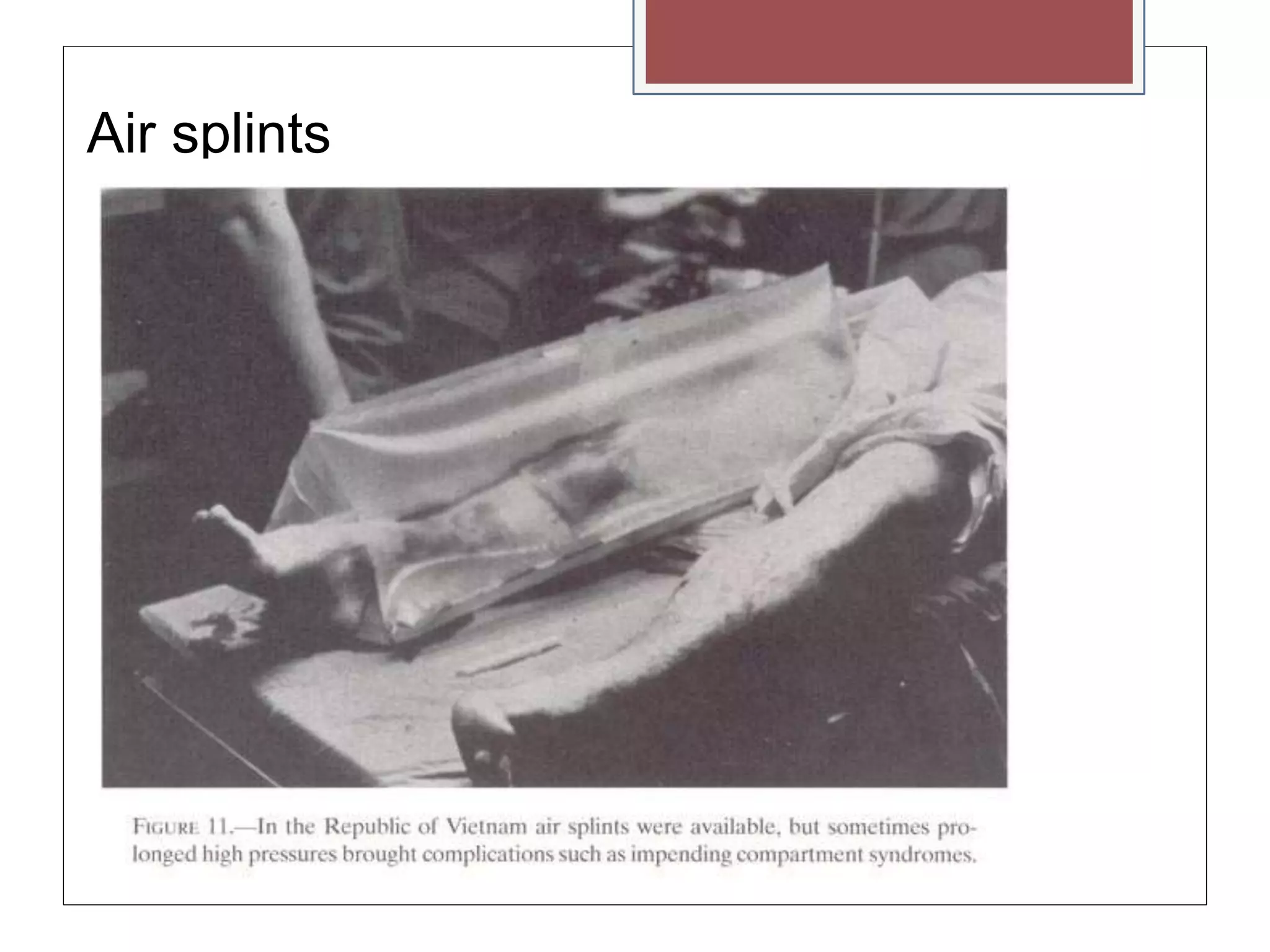 Ortho - Splinting, Traction, POP | PPT