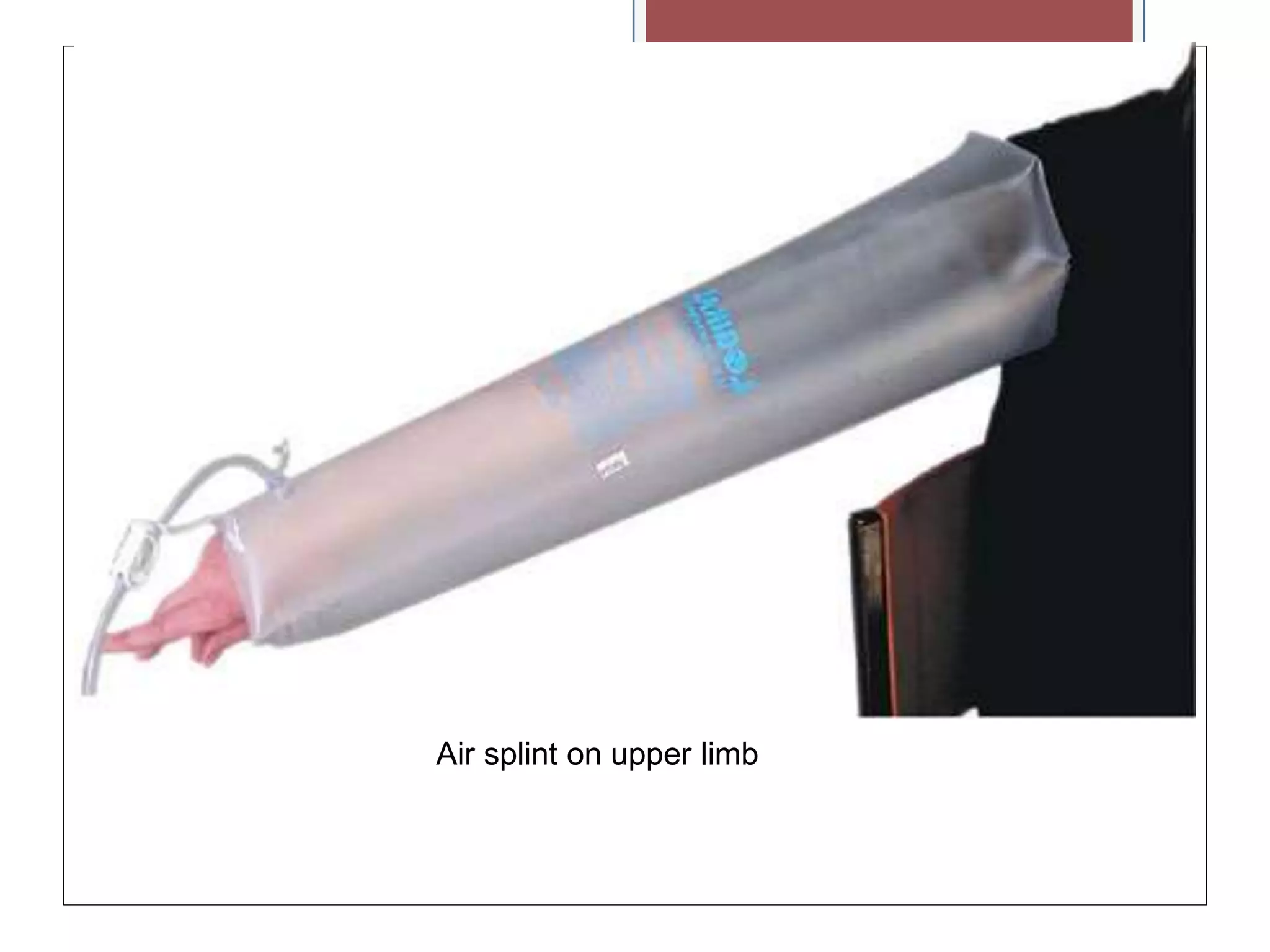 Ortho - Splinting, Traction, POP | PPT