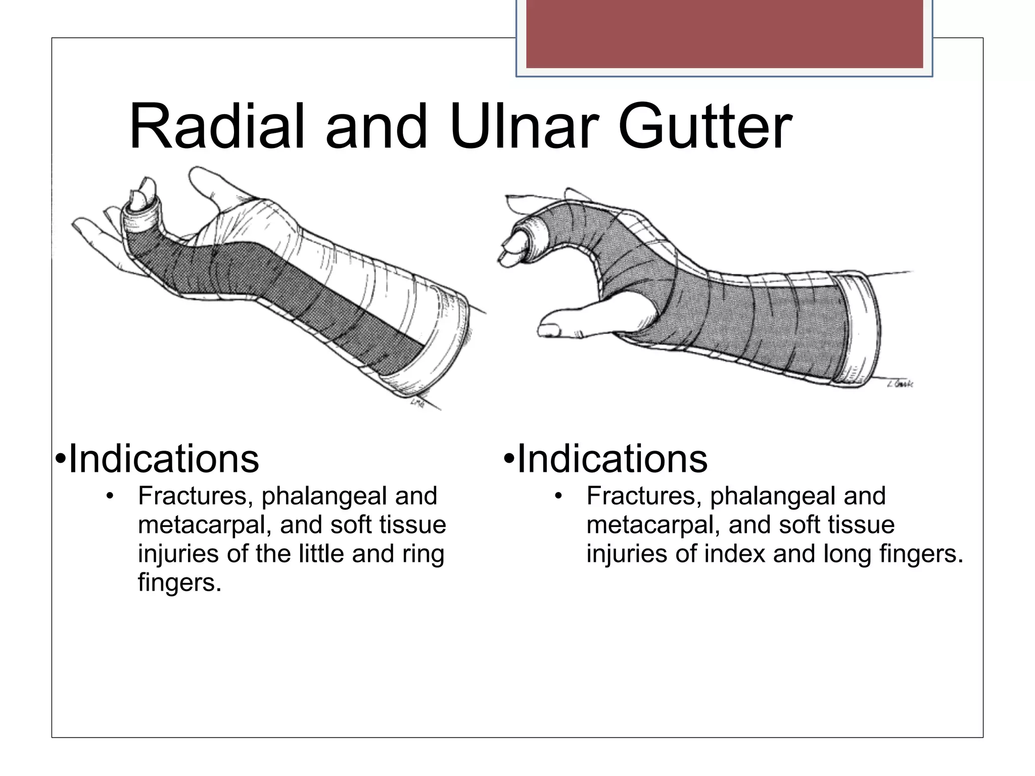 Ortho - Splinting, Traction, POP | PPT