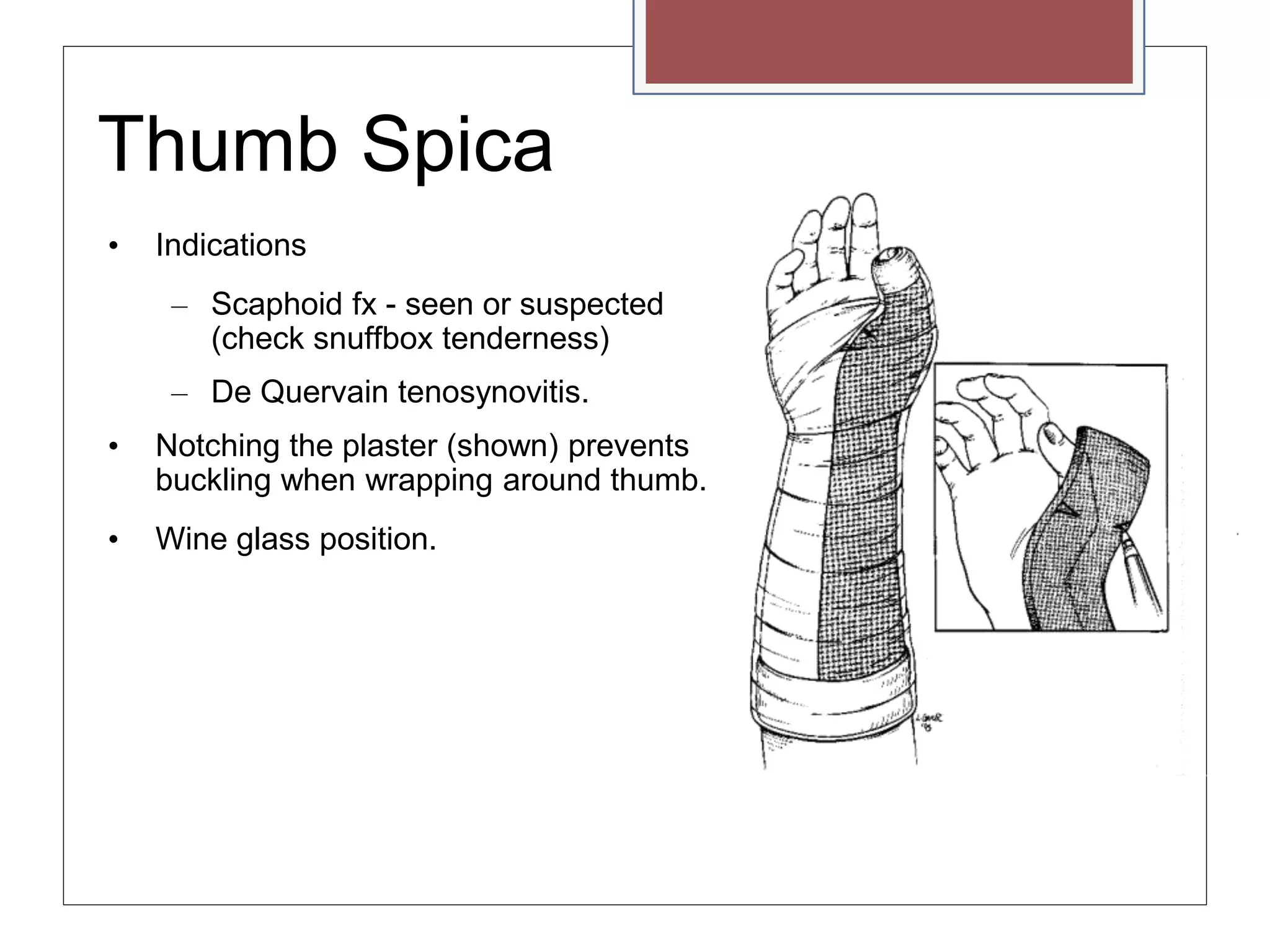 Ortho - Splinting, Traction, POP | PPT