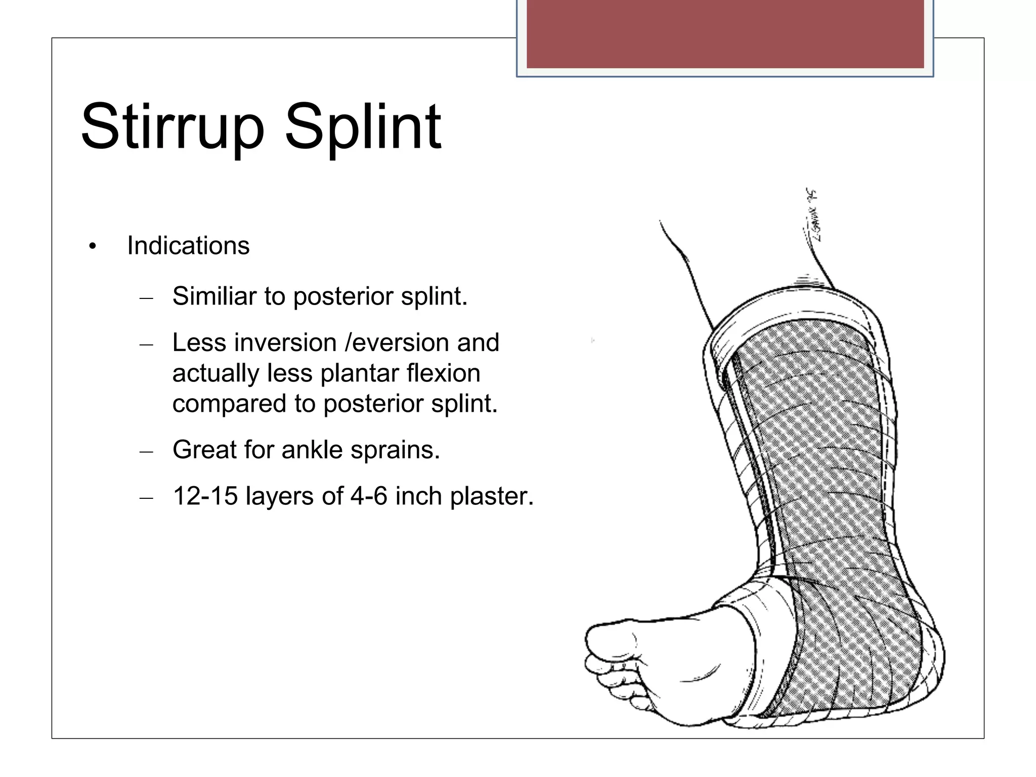 Ortho - Splinting, Traction, POP | PPT