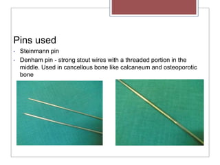 Ortho - Splinting, Traction, POP | PPT